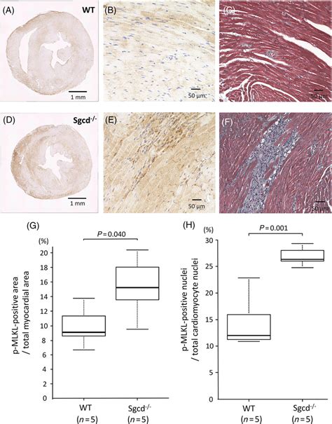 P‐mlkl Level In A Mouse Model Of Dilated Cardiomyopathy A B D E Download Scientific