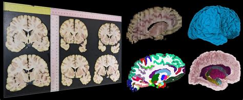 Calculating The Brain From Plain Dissection Photographs By Elife