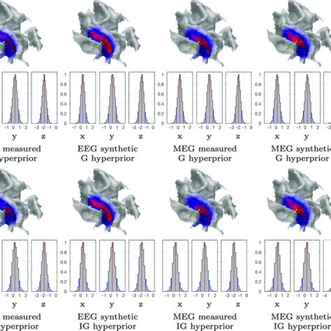 Subject I The Map Estimation Results Obtained With The Iterative