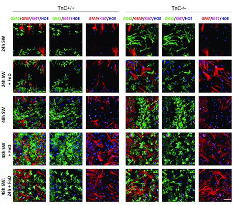 Representative Micrographs Of Gap Area Depicting Different Densities Download Scientific