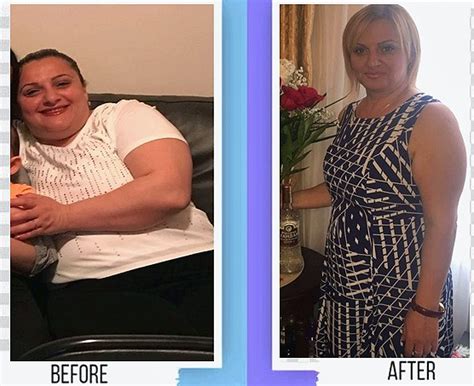 What Happens Each Week On Mounjaro Tirzepatide Side Effects Timeline