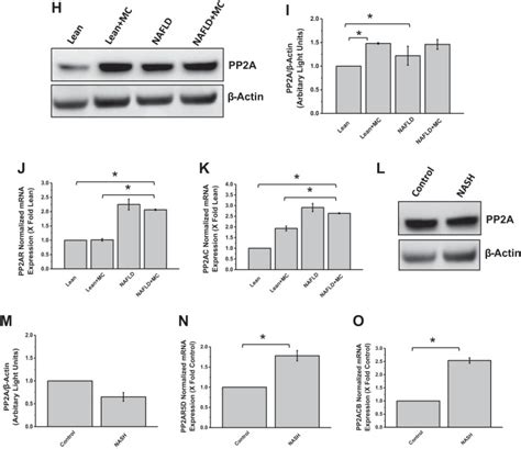 Exogenous Pp2a Inhibitor Exacerbates The Progression Of Nonalcoholic