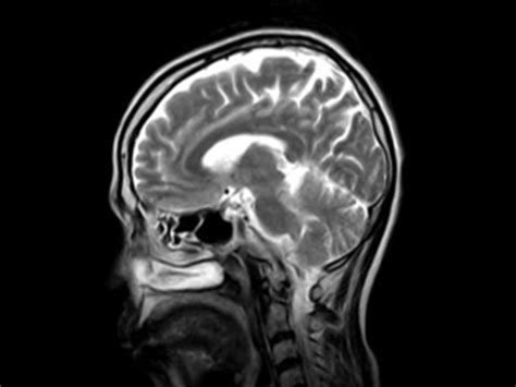 Climber 035 福晴医疗