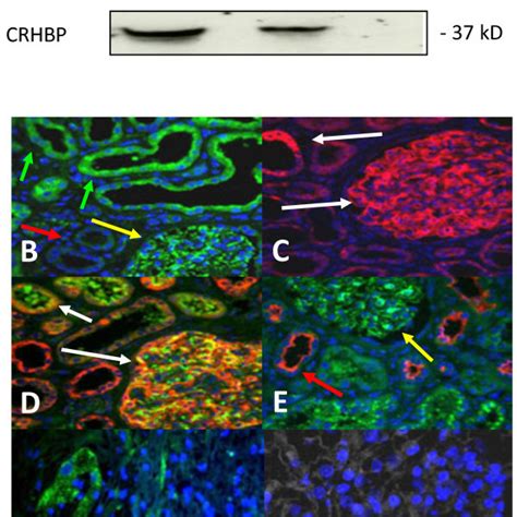Expression Of Crf Crfr1 And Hpa Components In The Cochlea Top