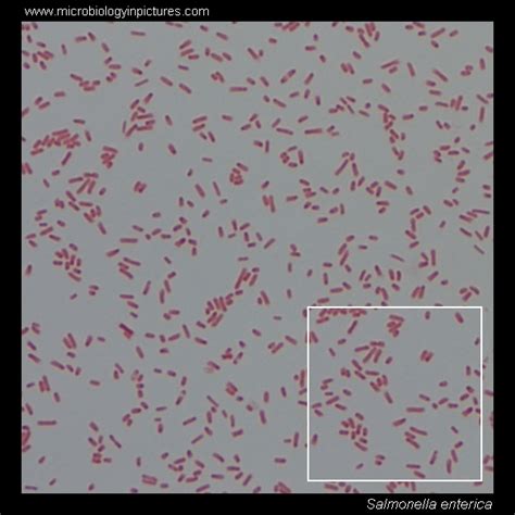 Salmonella Gram Stain Morphology At Henry Gale Blog