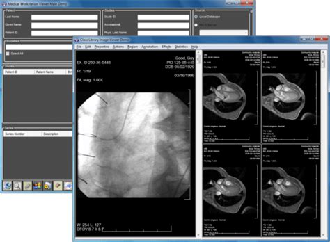Leadtools Medical Multimedia Module