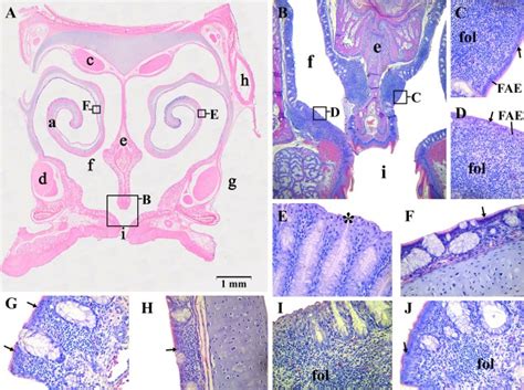 Concha Nasalis Inferior Anatomy Standard