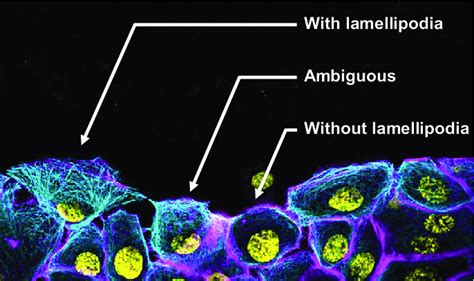 Fig E3 Lamellipodia Quantification Method Example Of Cells Classified