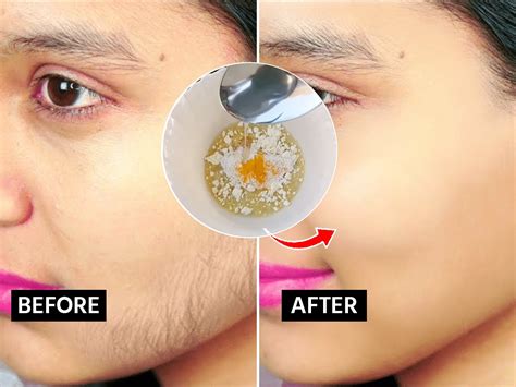How To Remove Facial Hairs ना थ्रेडींग ना पेनफूल वॅक्स चेहऱ्यावरचे