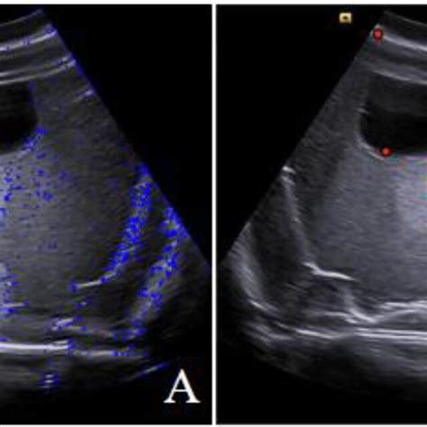 Obtain Corner Points And Feature Points Through Phantom A Harris