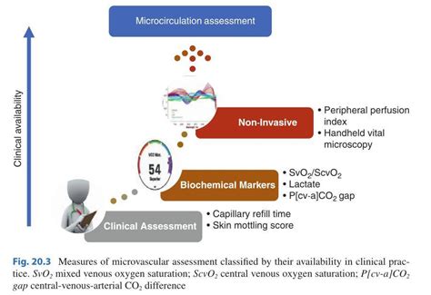 脓毒症患者的微循环：从生理到临床干预 搜狐大视野 搜狐新闻