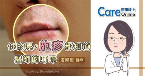 你的累，皰疹都知道 醫師的叮嚀 照護線上