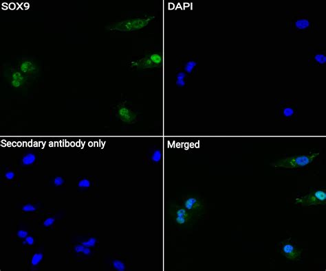 Sox9 抗体 Ya065（sox9 Antibody Ya065） Mce