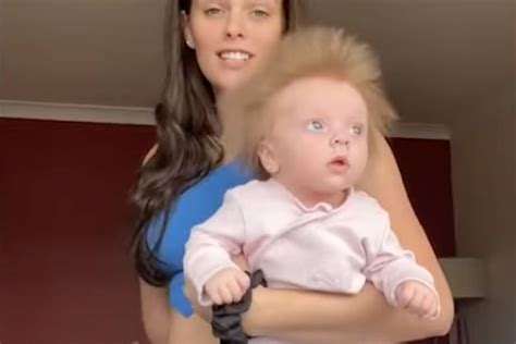 Божевільне волосся дитини стирчить на всі боки — всі заздрять їй