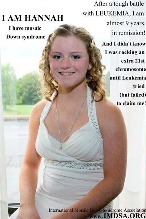 Er Det Lov å Ha Sex Med Noen Med Downs Syndrom Side 3 Seksualitet