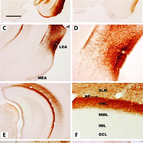 Pathologic Human Tau In The Mouse Perforant Pathway Mimics Braak Stage