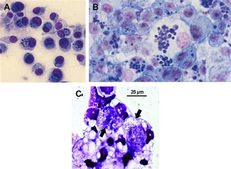 Human Ehrlichiosis And Anaplasmosis Clinics In Laboratory Medicine