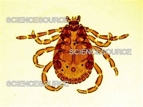 Brown Dog Tick Under A Microscope Stock Image Science Source Images