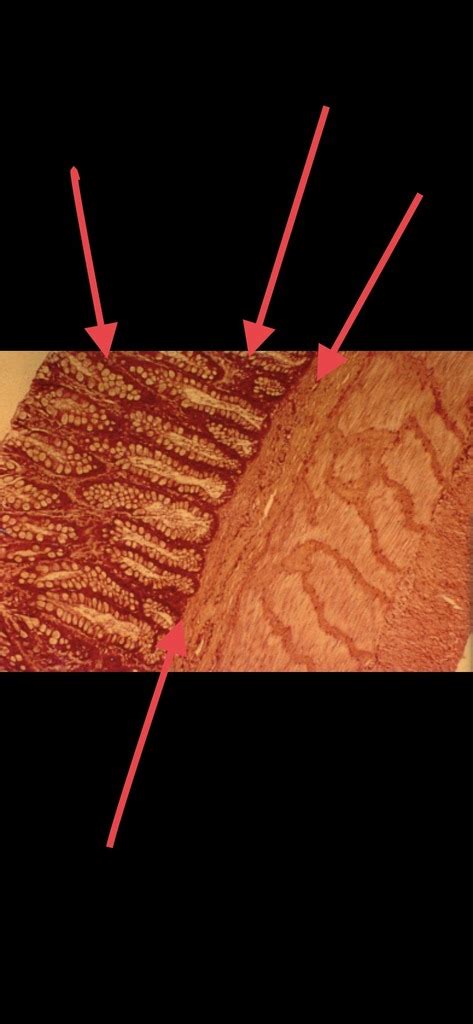 Large Intestine Diagram Quizlet