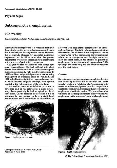 Subconjunctival Emphysema Pmc