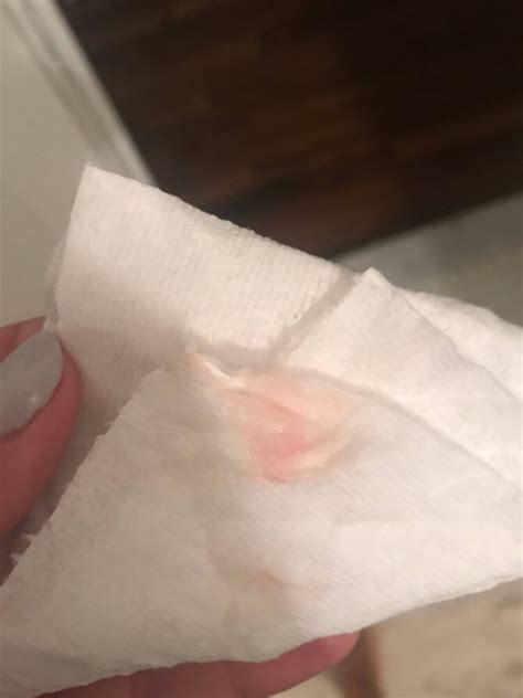 What Does Implantation Bleeding Look Like On A Pad