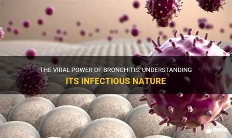 The Viral Power Of Bronchitis Understanding Its Infectious Nature