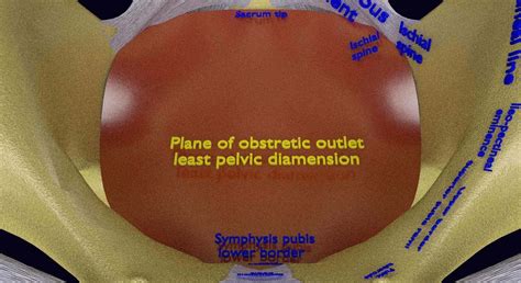 3d Model Female Pelvis Clinical Pelvimetry Dimension Vr Ar Low Poly