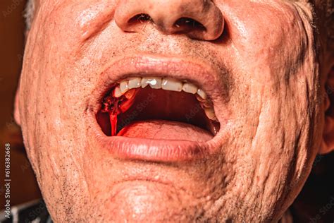Close Up Man Open Mouth Jaw With Teeth Detailed Sealed Bloody Tooth