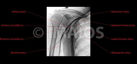 Shoulder Mri Radiographical And Illustrated Anatomical Atlas