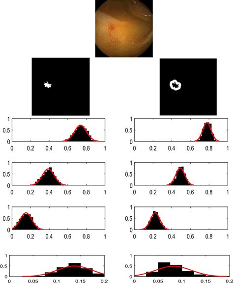 Distributions Of Pixel Values For An Image First Row In The Ad Lesion