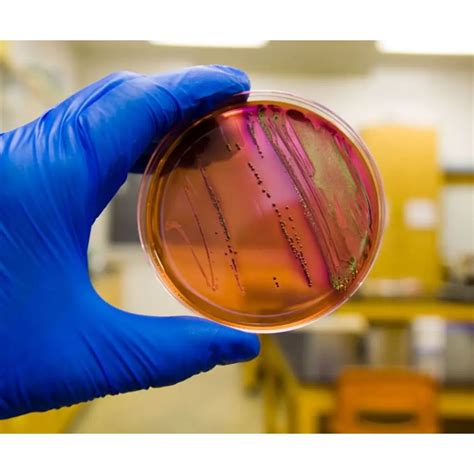 Stecsalmonella Broth Pdx Stec Paradigm Diagnostics