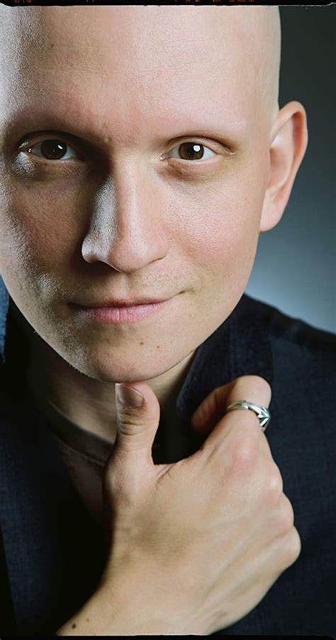 Anthony Carrigan Played The Mist On The Flash Last Week And Victor Zsasz On Gotham This Week