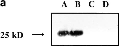 Lia11 And Vj116 Mabs Specifically Recognize The Cd151peta 3