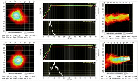 COMPLETE SOLUTION FOR PMDI PRODUCTS FROM DEVELOPMENT TO QUALITY CONTROL TESTING ONdrugDelivery