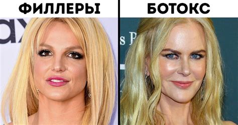 Неудачные пластические операции знаменитостей до и после 60 фото