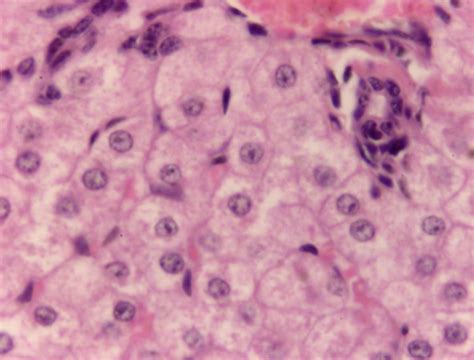 General Pathology Exam 2 Lecture Jimena Flashcards Quizlet