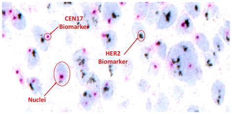 Computational Approach For Counting Of Sish Amplification Signals For