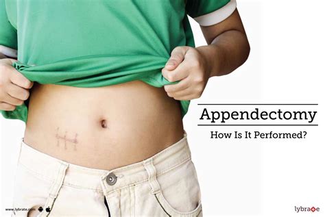 Dental Work After Appendectomy At Rita Skelley Blog