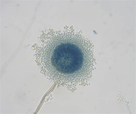 Aspergillus Ochraceus A Photo On Flickriver