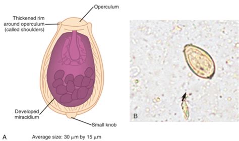 Clonorchis Sinensis Egg
