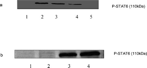Figure 1 From Histamine Affects Stat6 Phosphorylation Via Its Effects