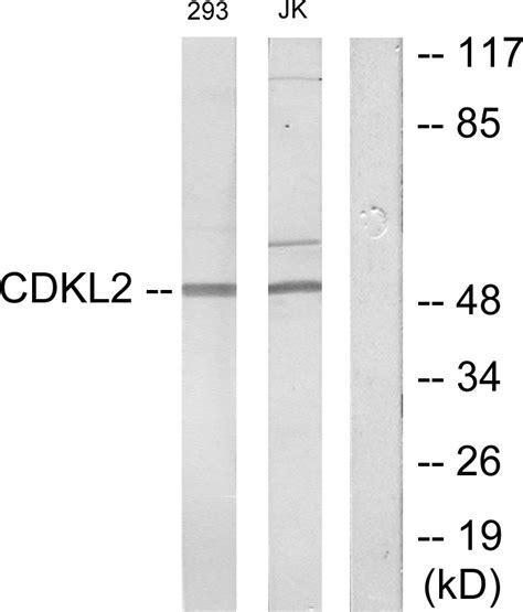 Cdkl2 Antibody Anti Cdkl2 Stjohnslabs