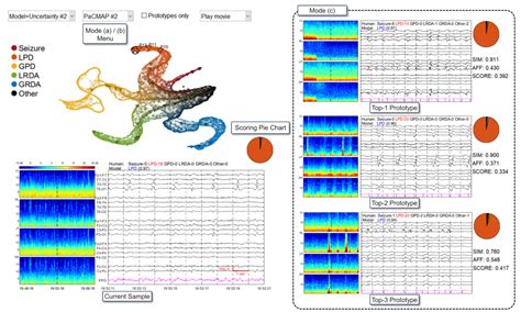 AI Helps Medical Professionals Read Confusing EEGs To Save Lives Duke Pratt School Of Engineering