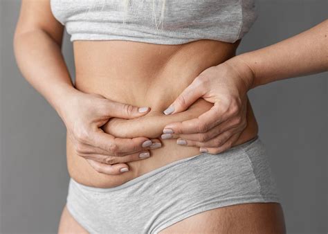 How Much Does Laser Stretch Mark Removal Cost Cocoon Wellness Spa
