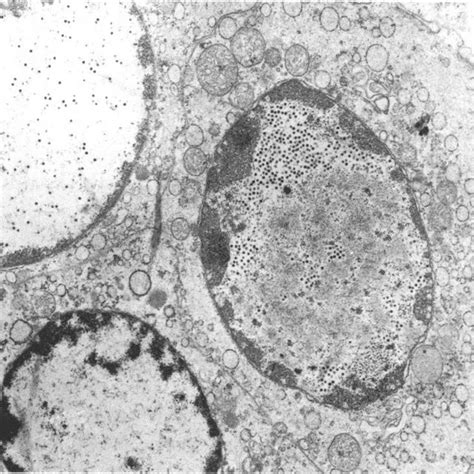 Electron Micrograph Of Intestinal Epithelial Cells The Nuclei Show