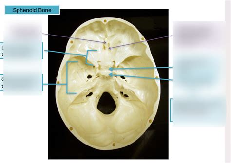 Sphenoid Bone Diagram Quizlet