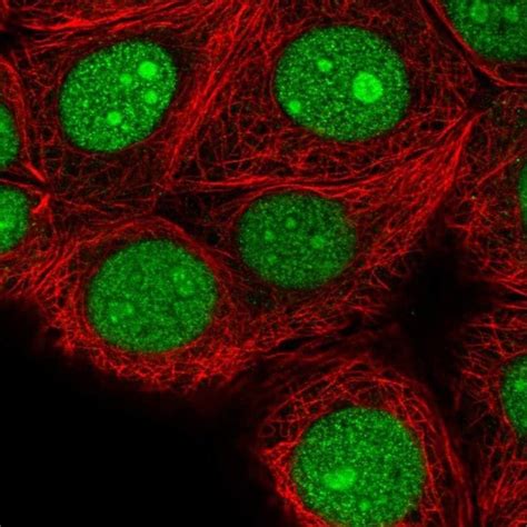 Invitrogen Spc24 Polyclonal Antibody 100 μl Unconjugated Antikroppar
