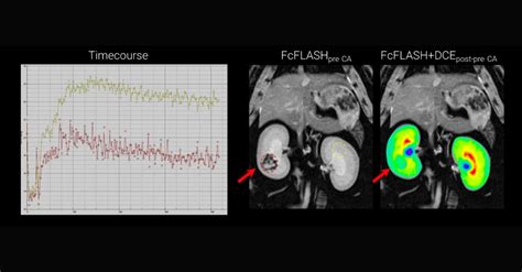 Biospec Maxwell Bruker Biospin