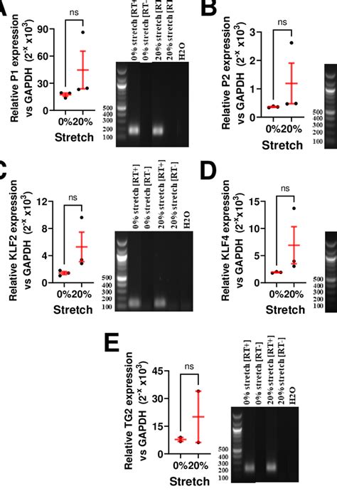 Relative Gene Expression And Gel Electrophoresis Blots Of Piezo 1 A