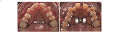 Expander Appliances A Mini Hyrax B Hyrax Download Scientific Diagram
